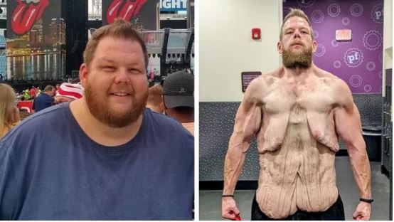 2년간 152kg 감량한 남성...충격적인 '상의 탈의' 사진 공개